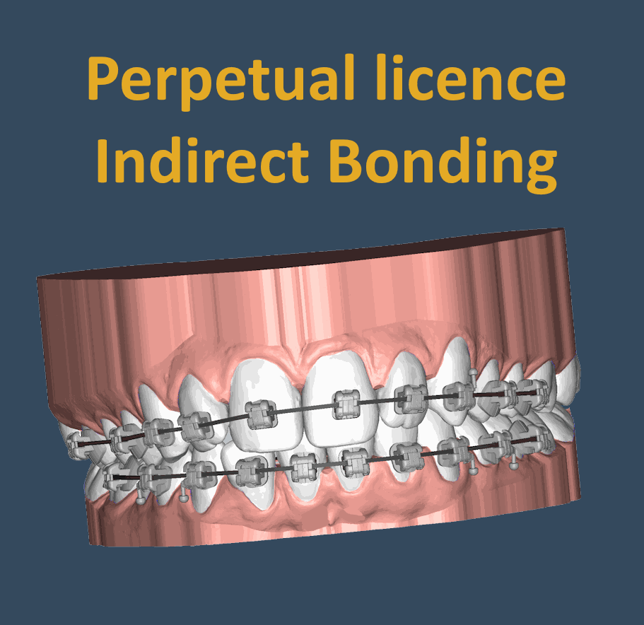 Indirect Bonding - Perpetual licence | 3D Orthodontic software CORUO